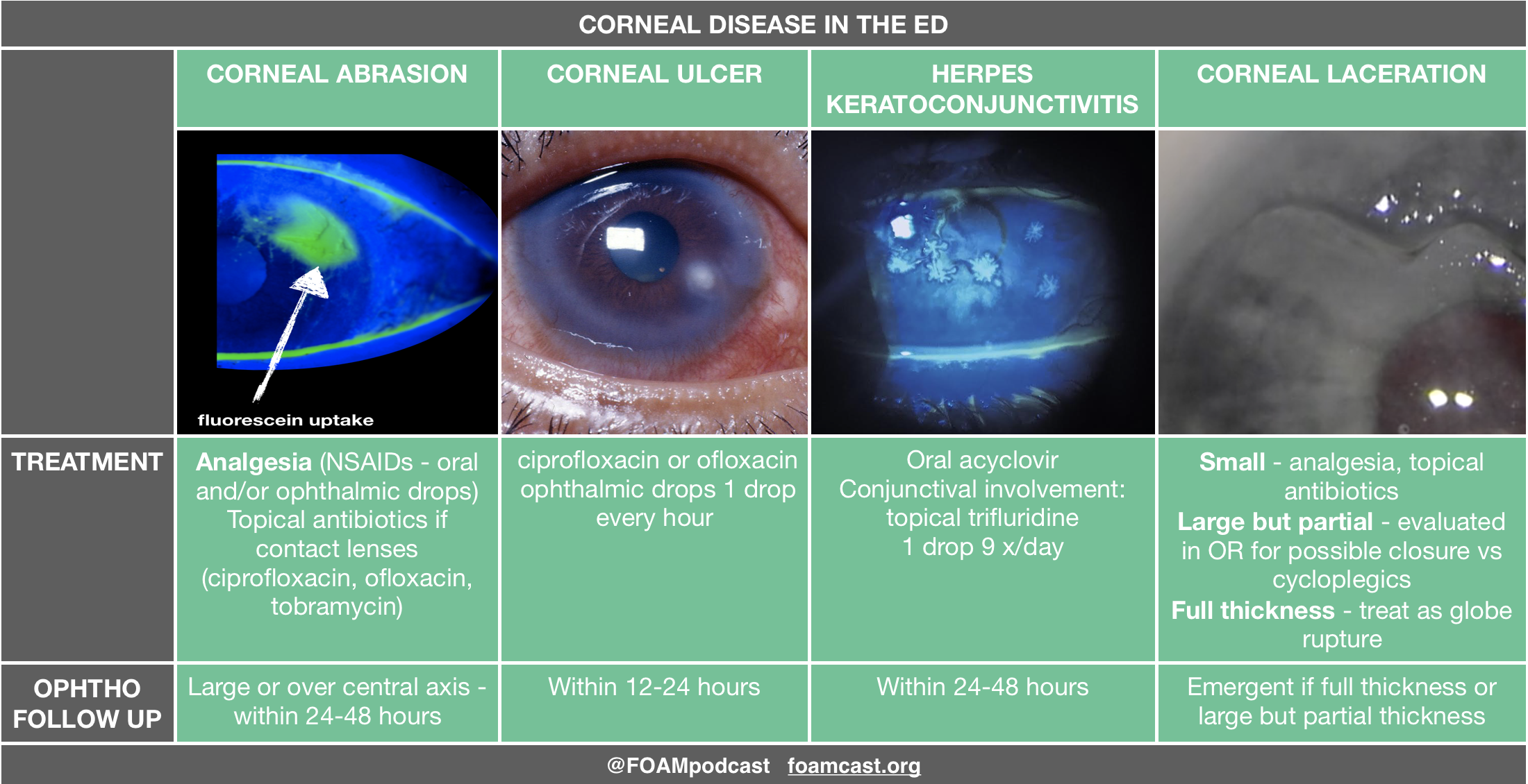 Corneal Emergencies FOAMcast